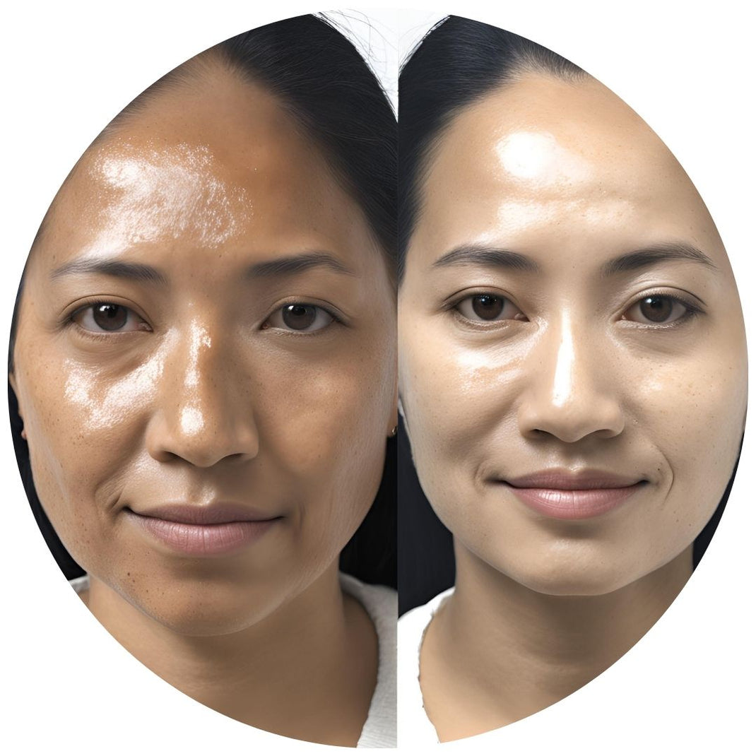 Best Skin Brightening & Lightening Products in Pakistan – Skinshop.pk